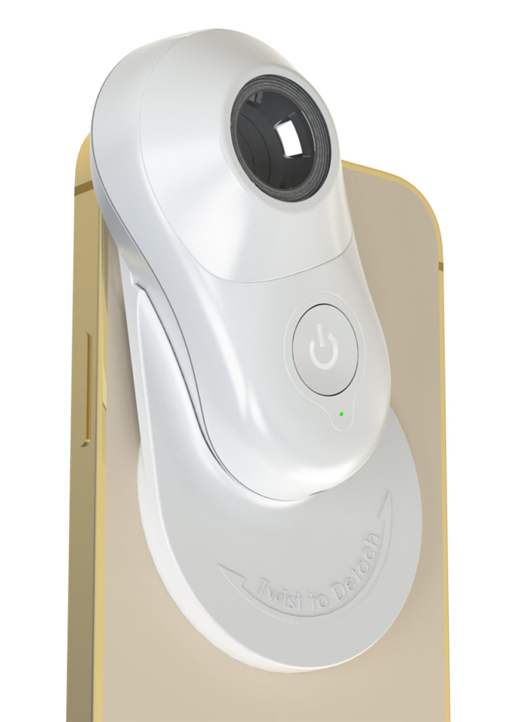 MoleScope II (Universal) – IDCP-MetaOptima-eu